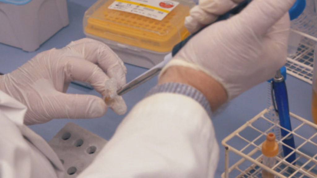 Treating post-vac syndrome – DW – 11/10/2022