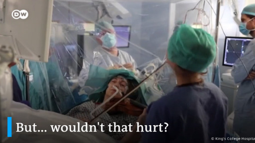 Awake during brain surgery?! – DW – 02/21/2020